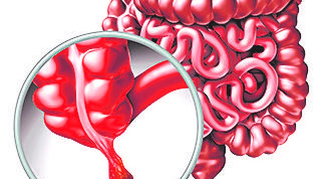 Your appendix plays a bigger role in your health than you may think ...